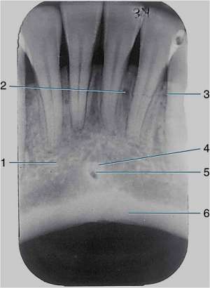 Flashcards - DHE 116 chapter#21 Radiographic Anatomy quiz