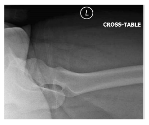 Flashcards - RTE1513RadProceduresII