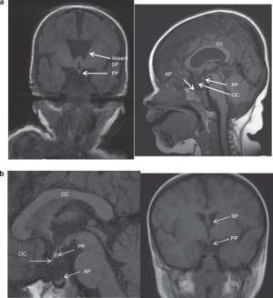 Flashcards - Embryology