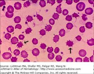 Flashcards - Chapter 9: Energy metabolism and membrane physiology of ...