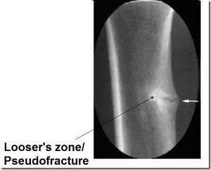 Flashcards - Radiology