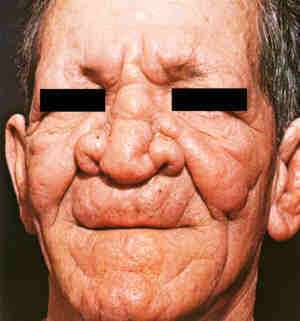 Flashcards - MICROBIOLOGY PHARMACOLOGY1